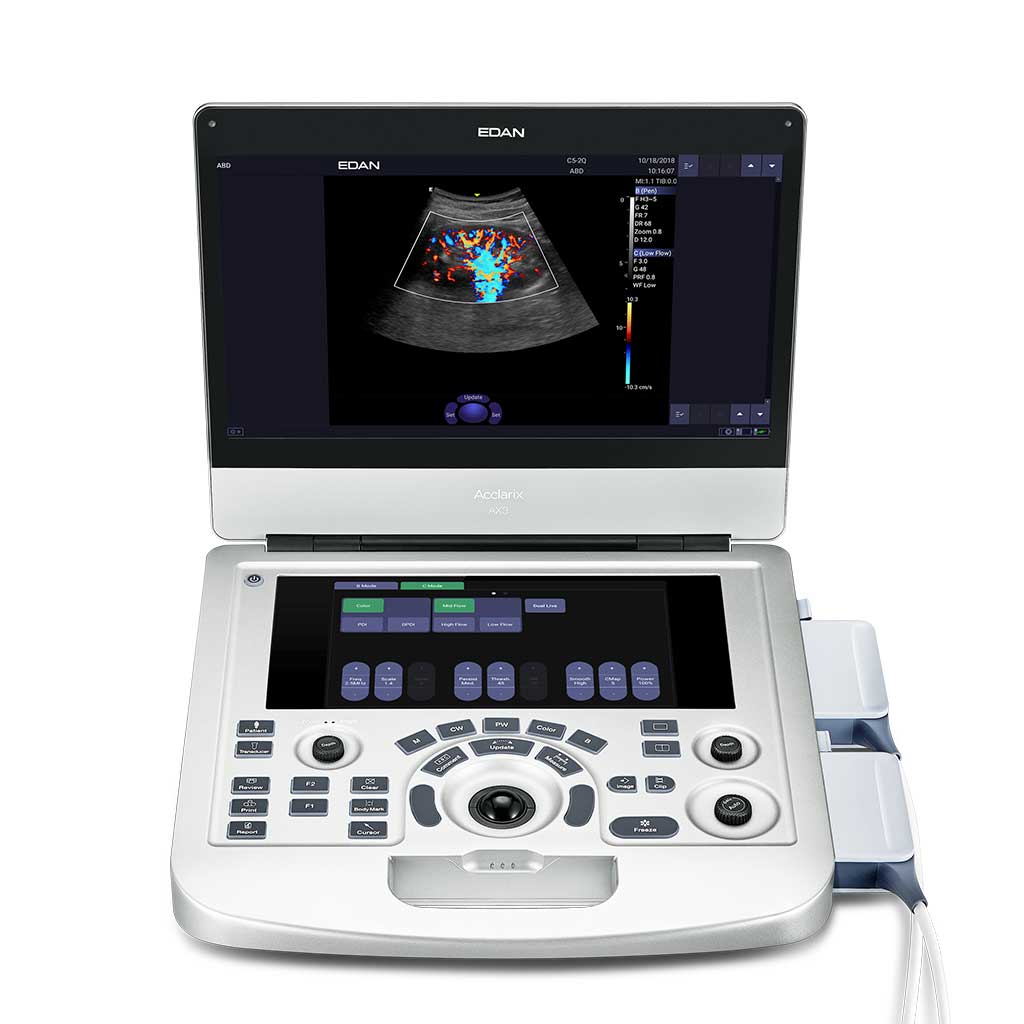 Ultrassom Portátil Acclarix AX3 - Edan